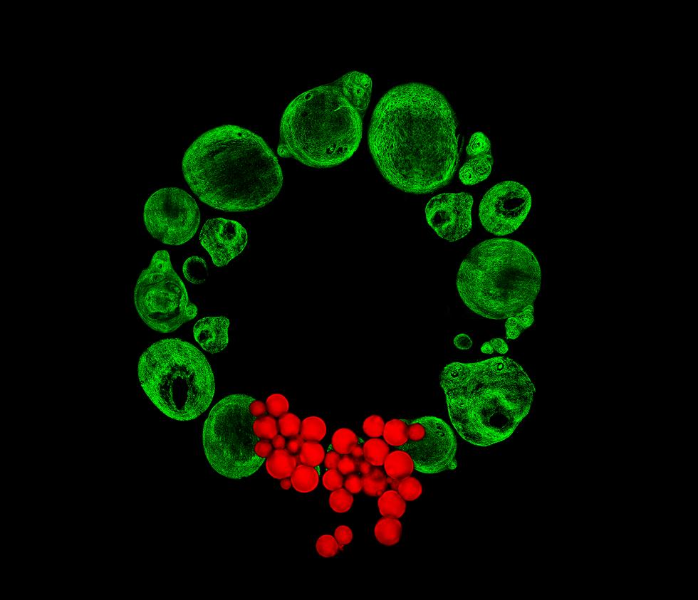 Images of Christmas wreath and Christmas tree reflect stem cells science