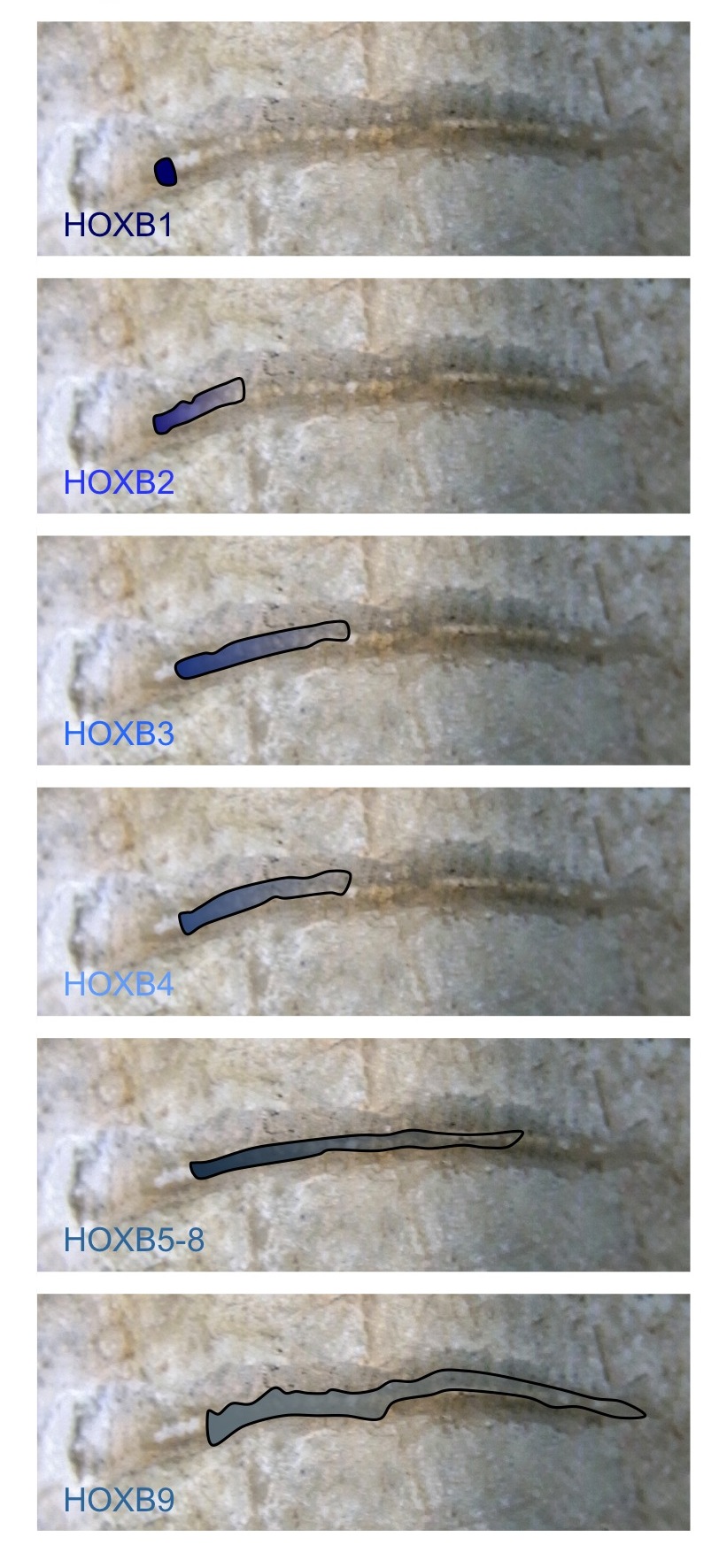 HOX genes: HOX transcription factors as biomarkers in cancer
