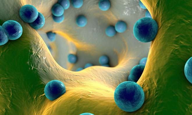 Osteomyelitis: How artificial bone grafts are filling the gap